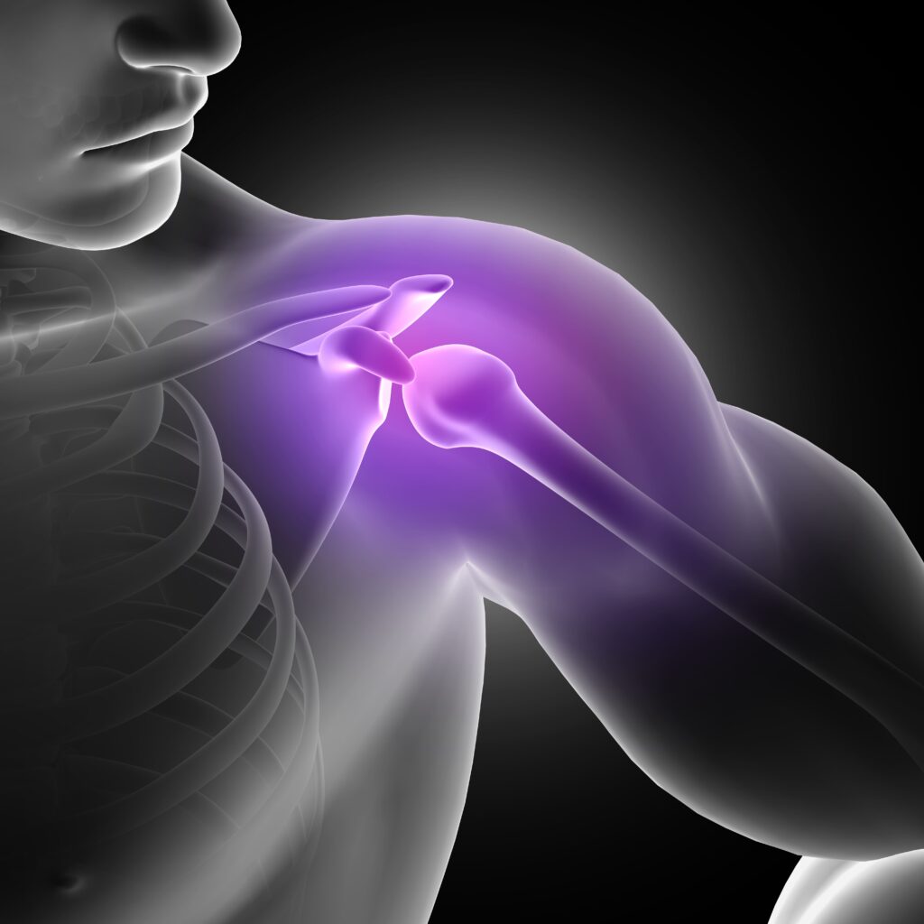 Shoulder Pain Relief Without Surgery: PT & Self-Care Tips